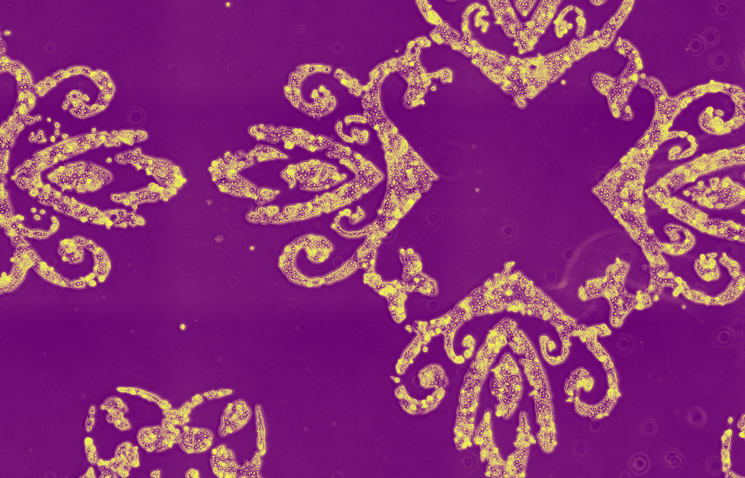 Tal Danino programs bacteria to detect cancer — and make art | TED Blog